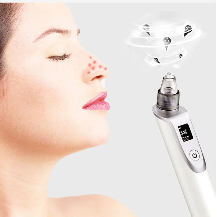 Pore Cleanser Ultrasonic Blackhead Remover Device – Gloww Cosmetics